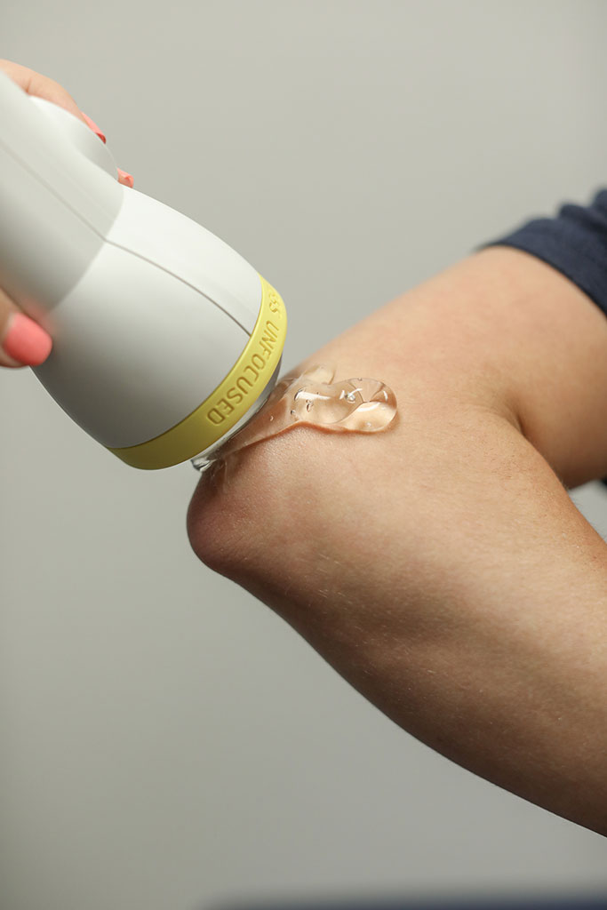 Tissue Regenerative Therapy – Wright Wellness Center